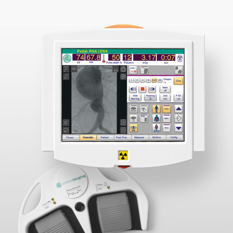 Ziehm Vision RFD mobile C-arm, surgical Carm, fluoroscopy