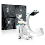 Ziehm Vision RFD 3D Mobile C-arm for surgical x-ray imaging