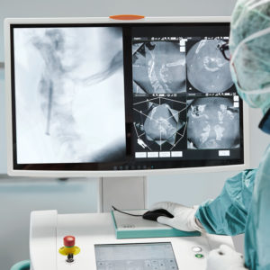 Ziehm Vision RFD 3D Mobile C-arm for surgical x-ray imaging