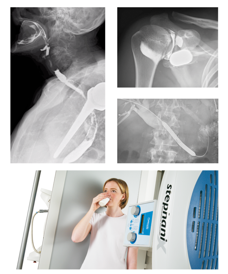 D2RS Static X-ray System