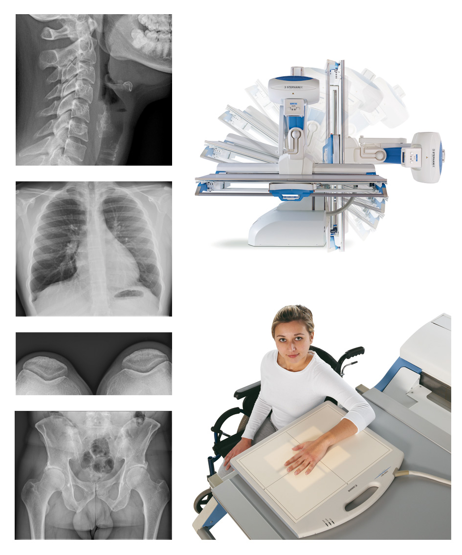 D2RS Static X-ray System