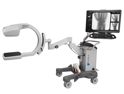 Mini C-arm • X-ray Fluoroscopy systems from Xograph Healthcare