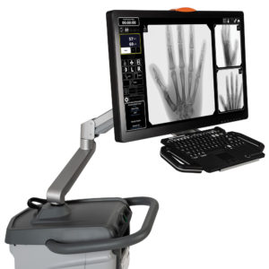 TAU - Mini C-arm X-ray system from Xograph Healthcare