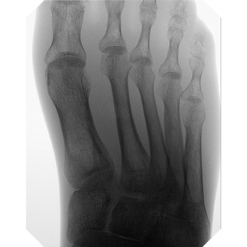 TAU 1512 - Xograph Healthcare UK