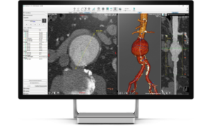 EndoSize - Xograph Healthcare UK