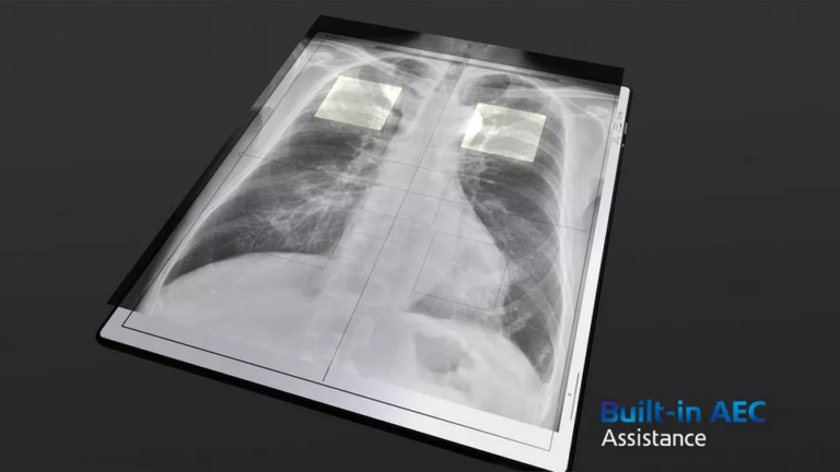 CXDI-Elite series range - Xograph Healthcare UK